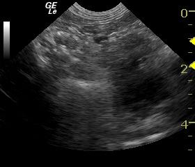 Marked pancreatitis, steatitis, and necrosis in a 7 year old MN DSH cat ...