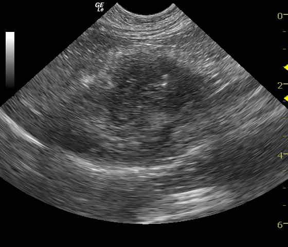 Marked pancreatitis, steatitis, and necrosis in a 7 year old MN DSH cat ...
