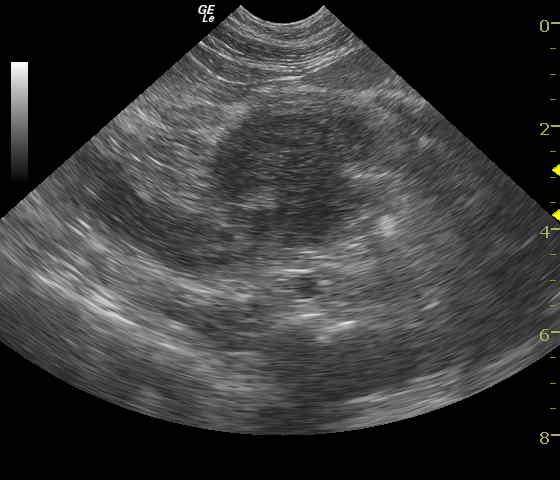 Marked pancreatitis, steatitis, and necrosis in a 7 year old MN DSH cat ...