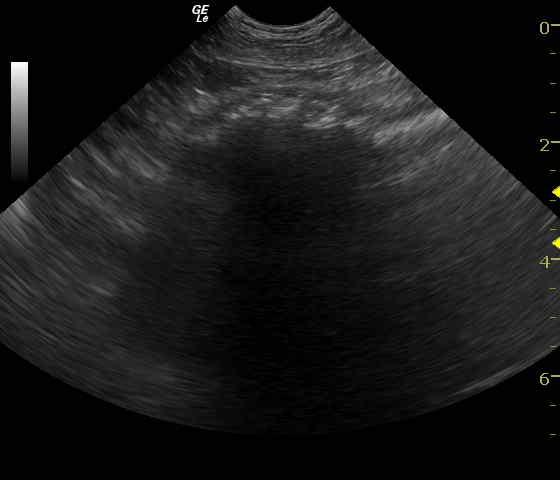 Fluid-absorbing intestinal foreign body in a 7 year old FS Jack Russell ...