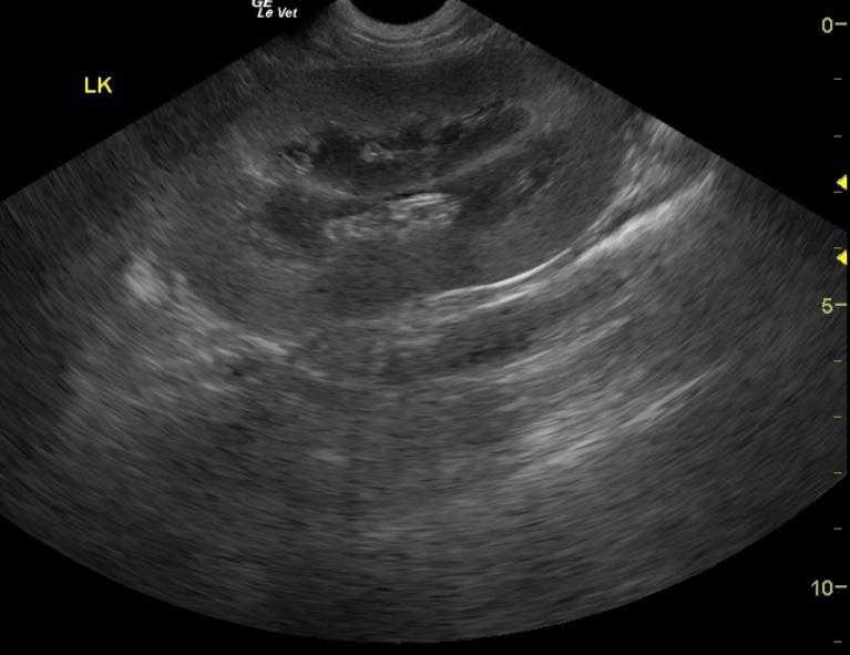 Protein losing nephropathy, glomerulonephritis, and uremic gastritis in ...