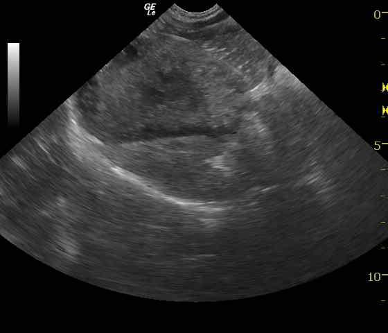 03_00107 Casey D Feline Gall bladder mucocele -needs video - Members