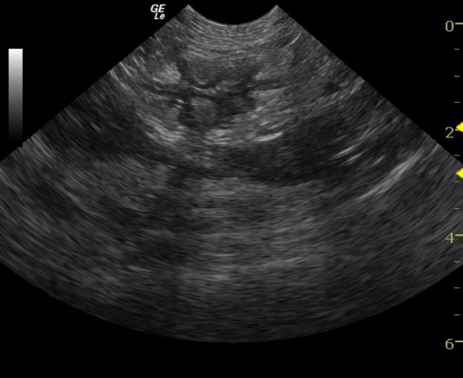 Gastritis (likely a granulomatous lesion) in an 11 year old FS Persian ...