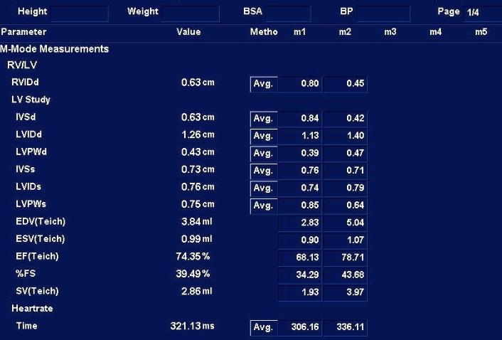 Normal Echocardiogram with a Flow Murmur in a 4 year old cat, Negative ...