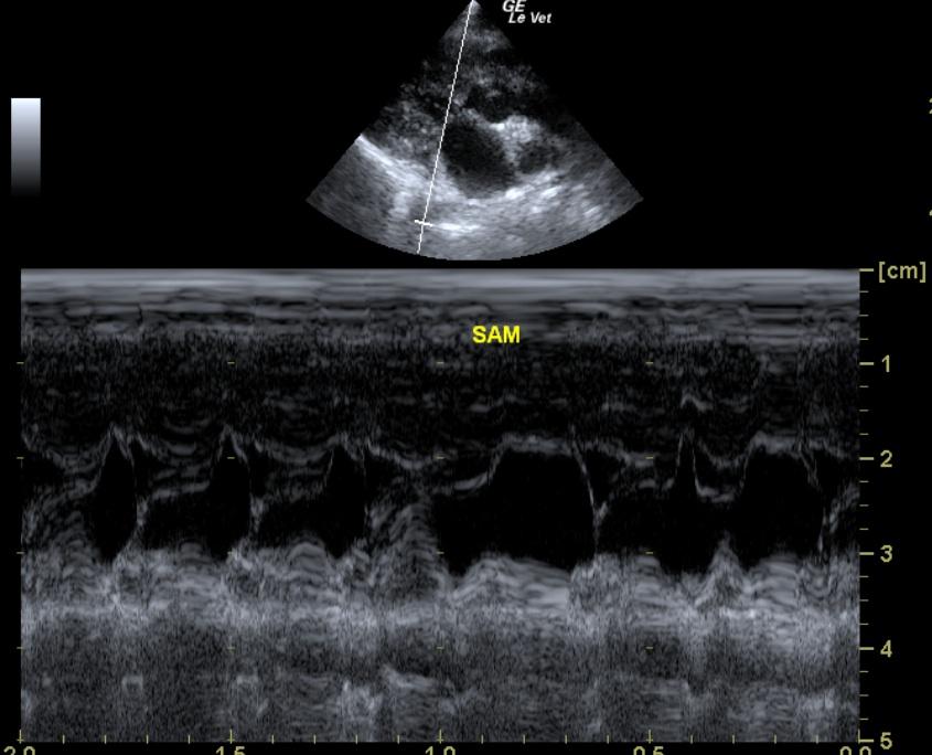Hypertrophic cardiomyopathy and mitral insufficiency in a 14 year old ...