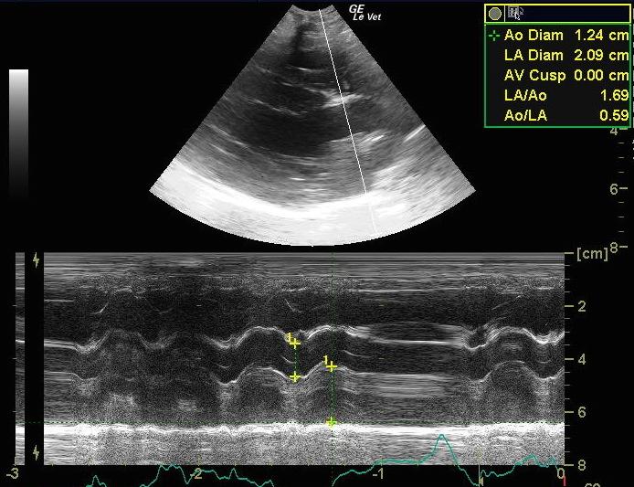 15_00071 St. Oliver S DVD, moderate MI, mild TI - Members