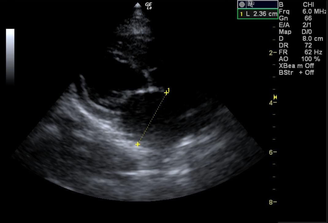 Feline Dilated Cardiomyopathy, Emergency Rapid Echocardiogram for ...