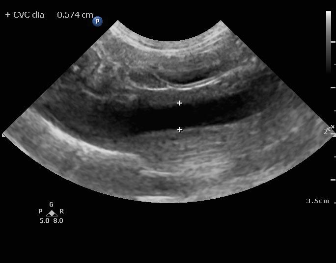 Splenoazygous shunt in an 8 year old FS Maltese - Members
