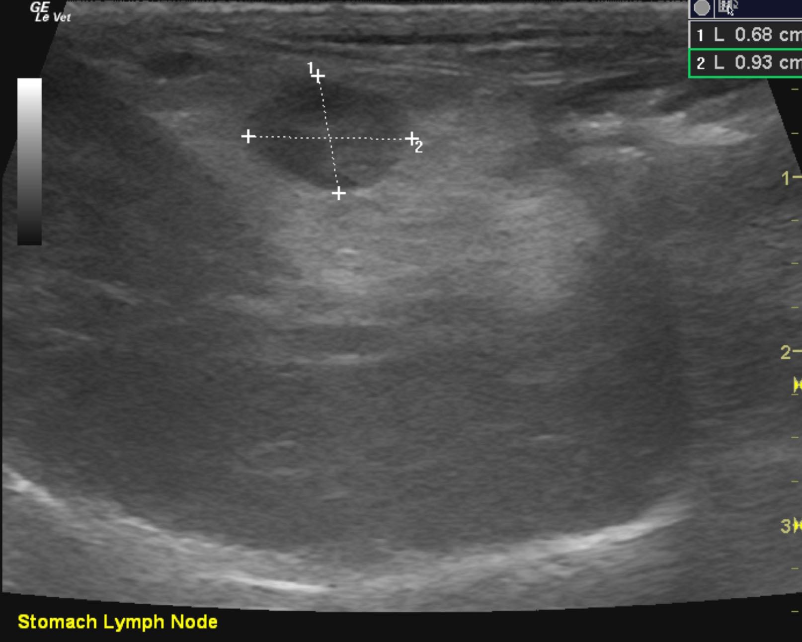 Splenic hyperplasia and extramedullary hematopoiesis in a 5 year old FS ...