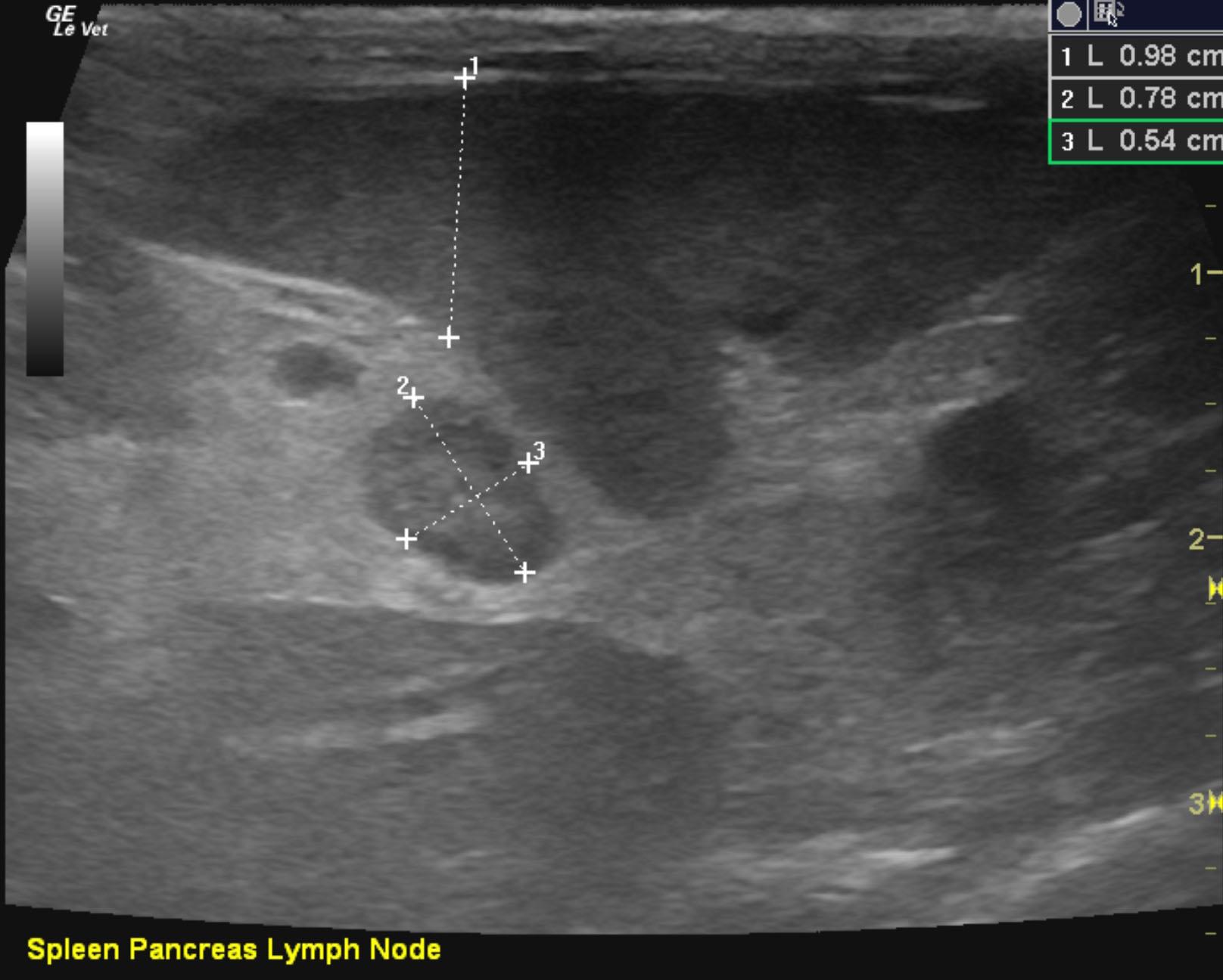 Splenic hyperplasia and extramedullary hematopoiesis in a 5 year old FS ...