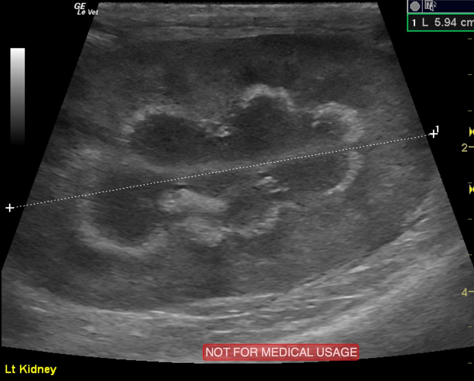 06-00230 Lego W Renal lymphoma vs FIP -NEED SL- Members
