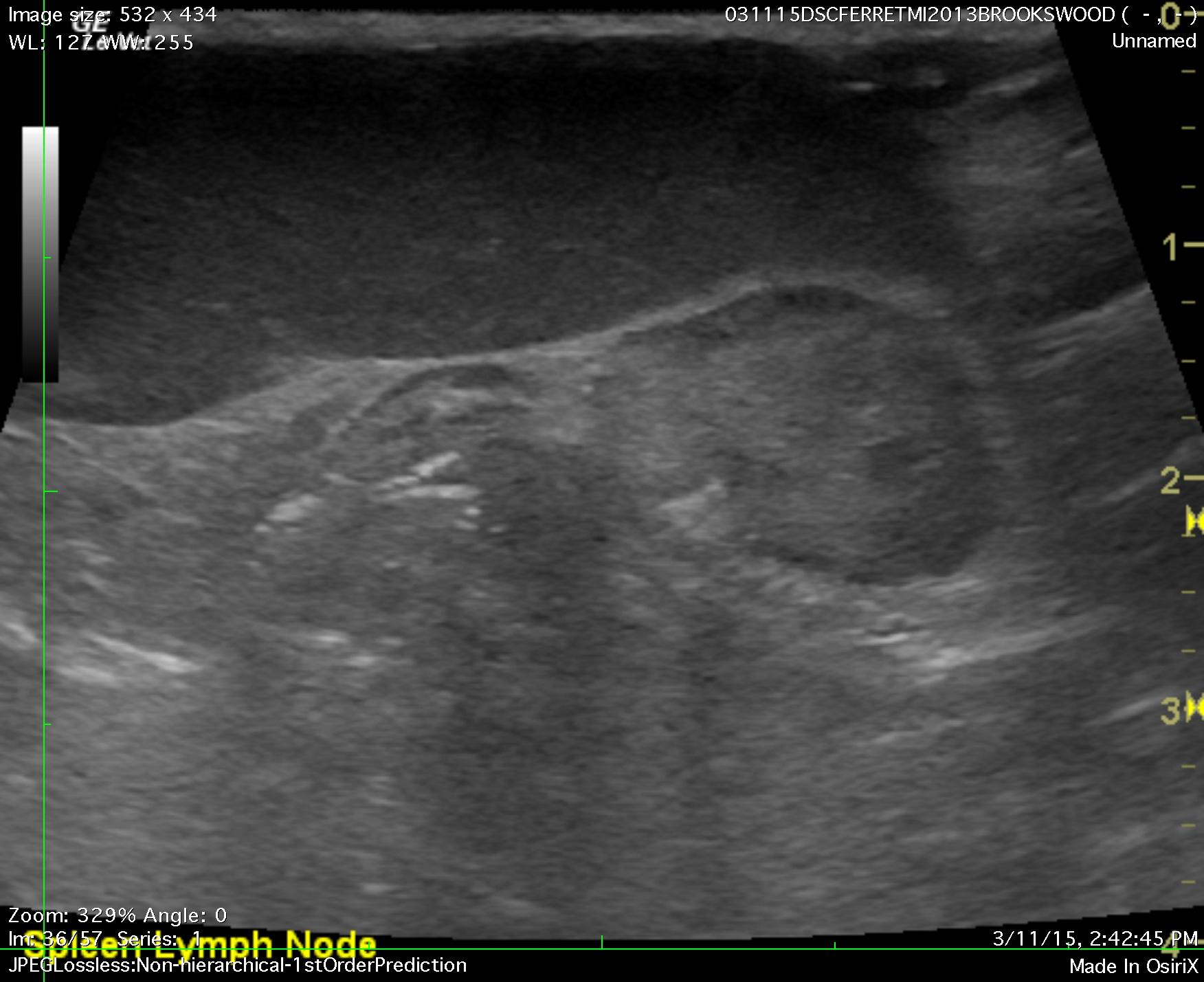 11-00051 Finn L Multicentric LSA -NEED CDX, SB- Members