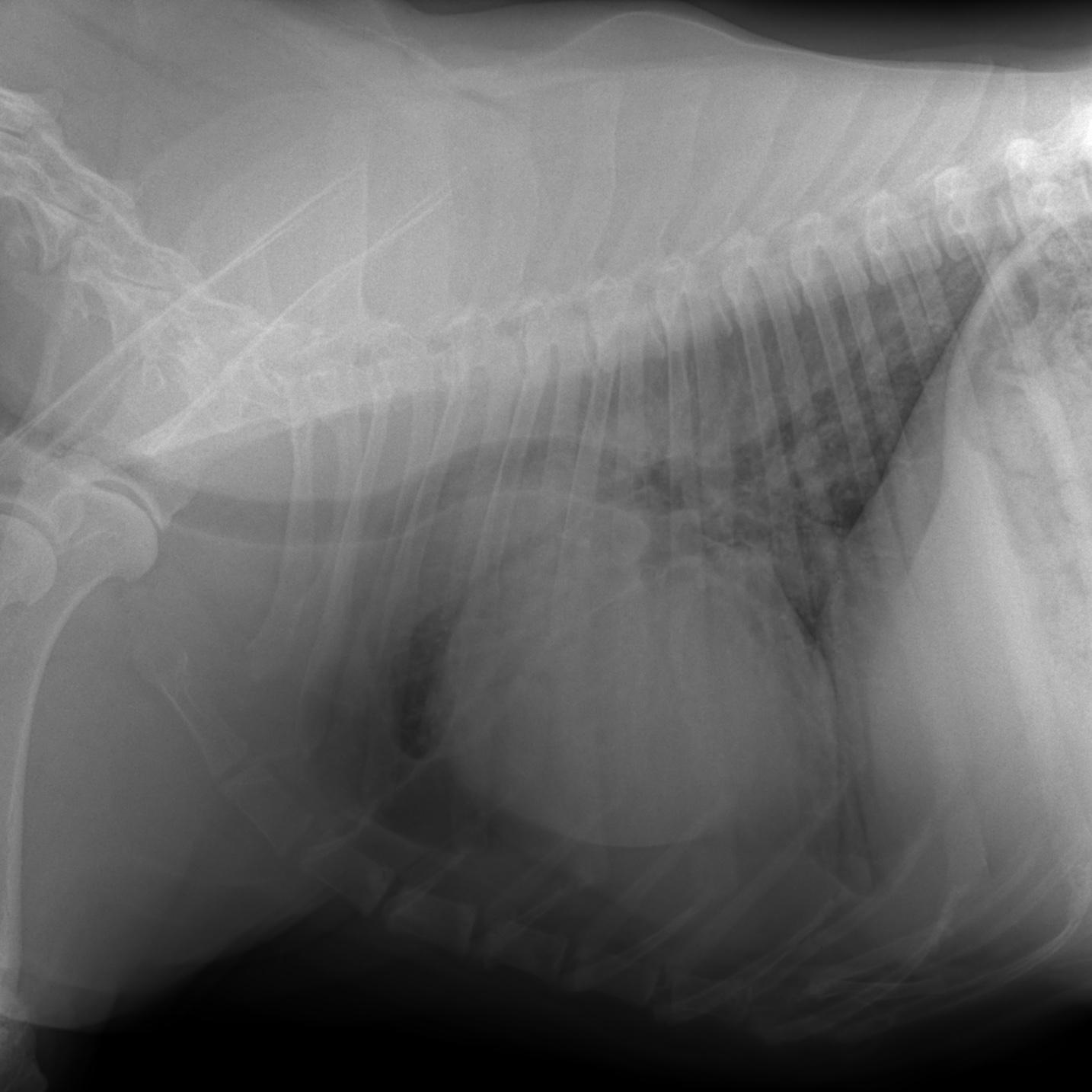 RADS - Chronic Upper Airway Obstruction with Chronic Inflammatory ...