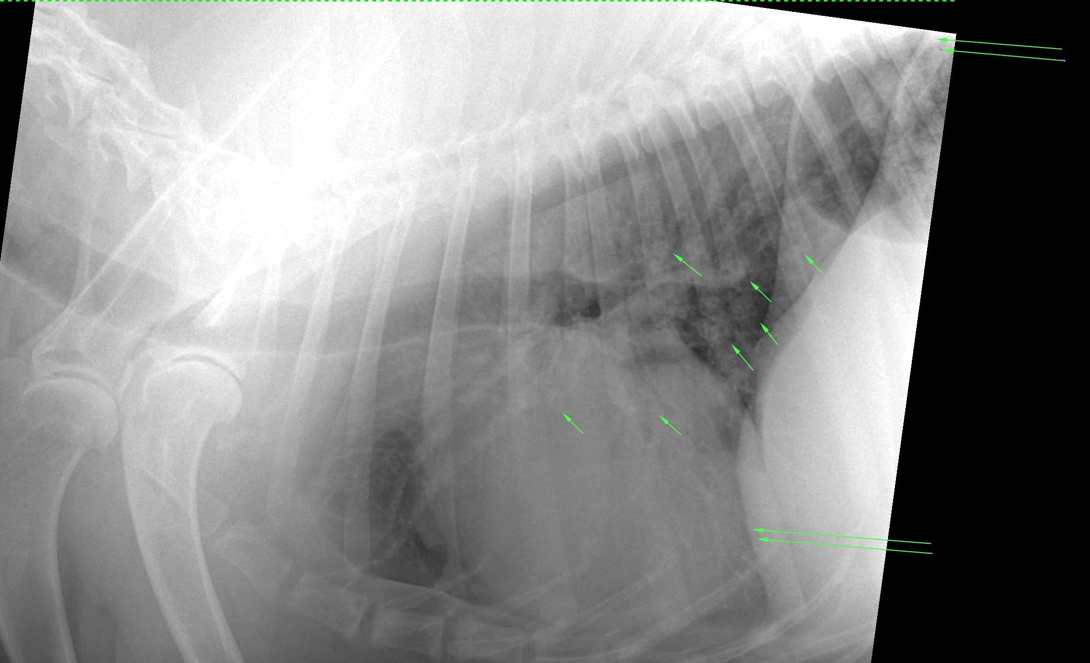 RADS - Chronic Upper Airway Obstruction with Chronic Inflammatory ...
