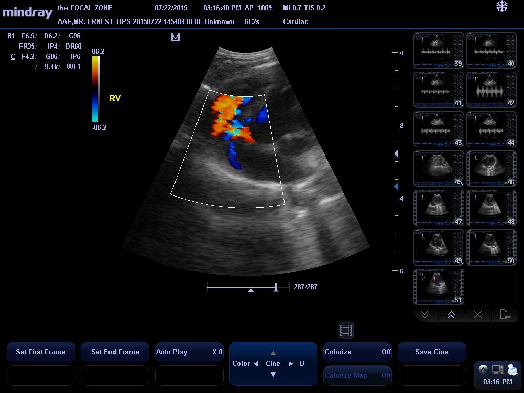 Ventricular Septal Defect, Restrictive, in a 4 month old male DSH cat ...