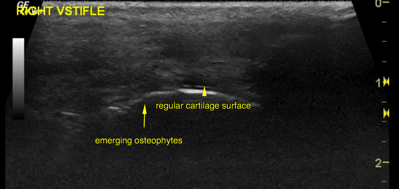 ORTHO - Rupture of the left cranial cruciate ligament (CCL) with ...
