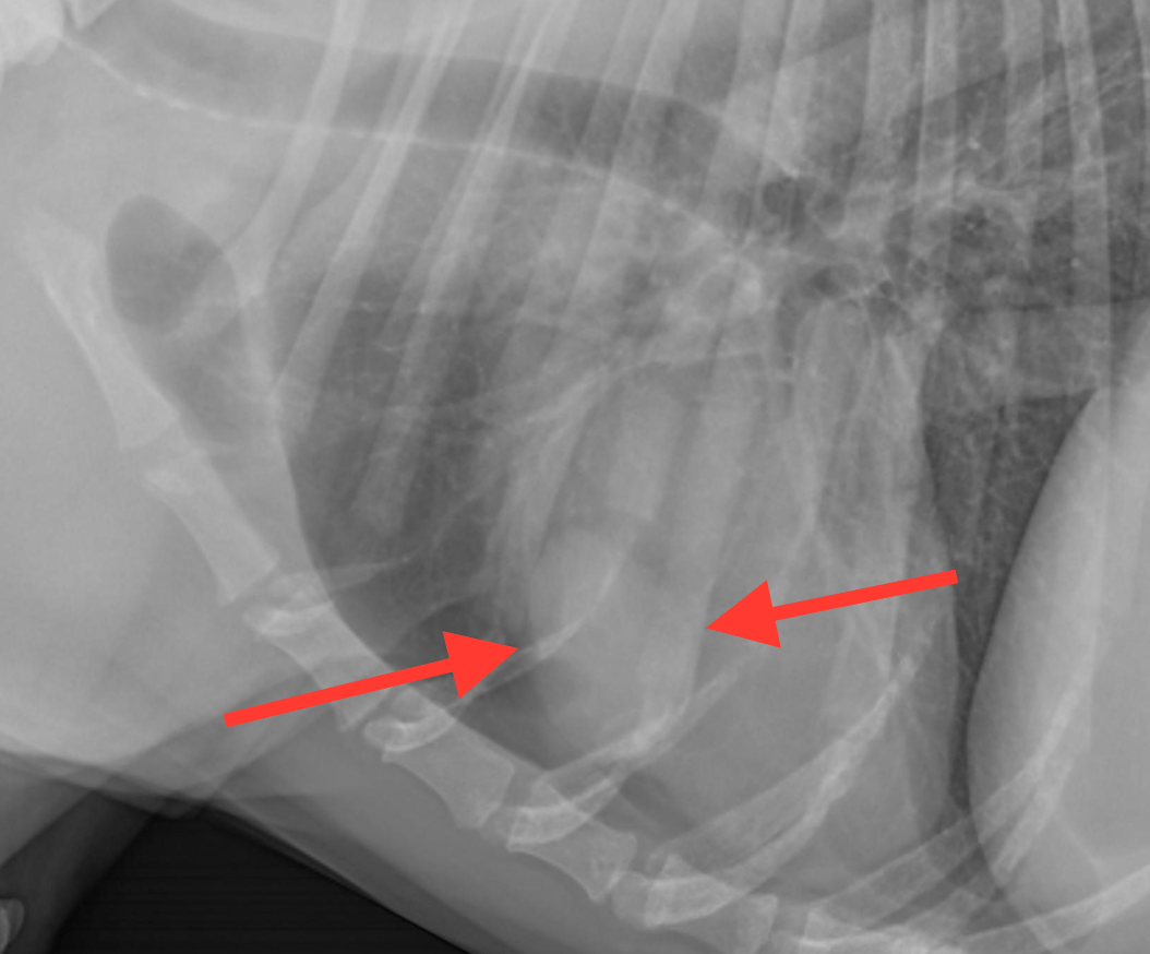 RAD - Mesenteric lymphadenopathy, lung lobe consolidation, splenomegaly ...