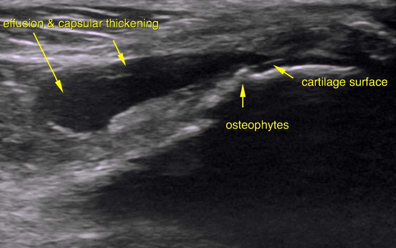 ORTHO -Chronic degenerative joint disease (DJD) with cranial cruciate ...