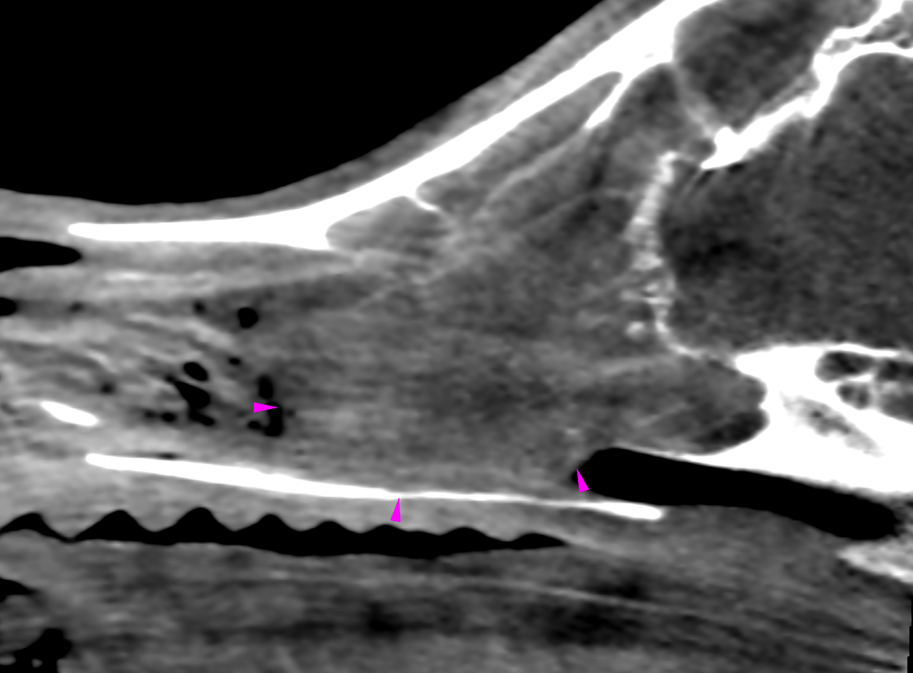 CT - Nasal soft tissue neoplasia with osteolysis, rhinitis and ...