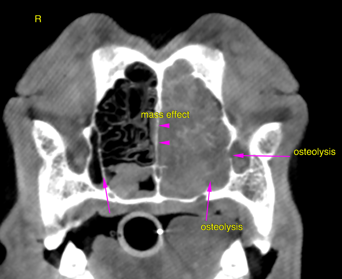 CT - Nasal soft tissue neoplasia with osteolysis, rhinitis and ...