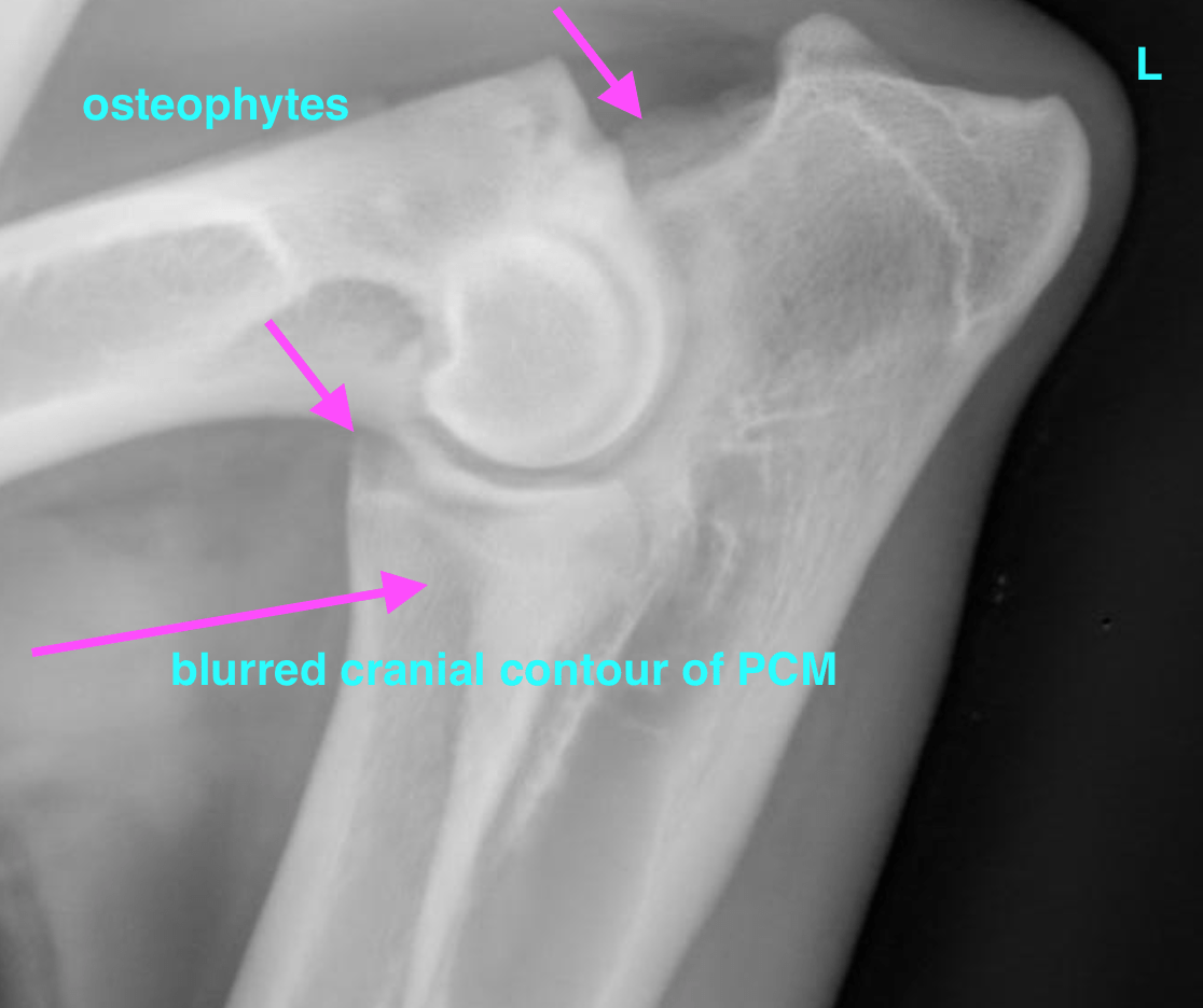 RAD - Bilateral elbow dysplasia with coronoid pathology and possible ...