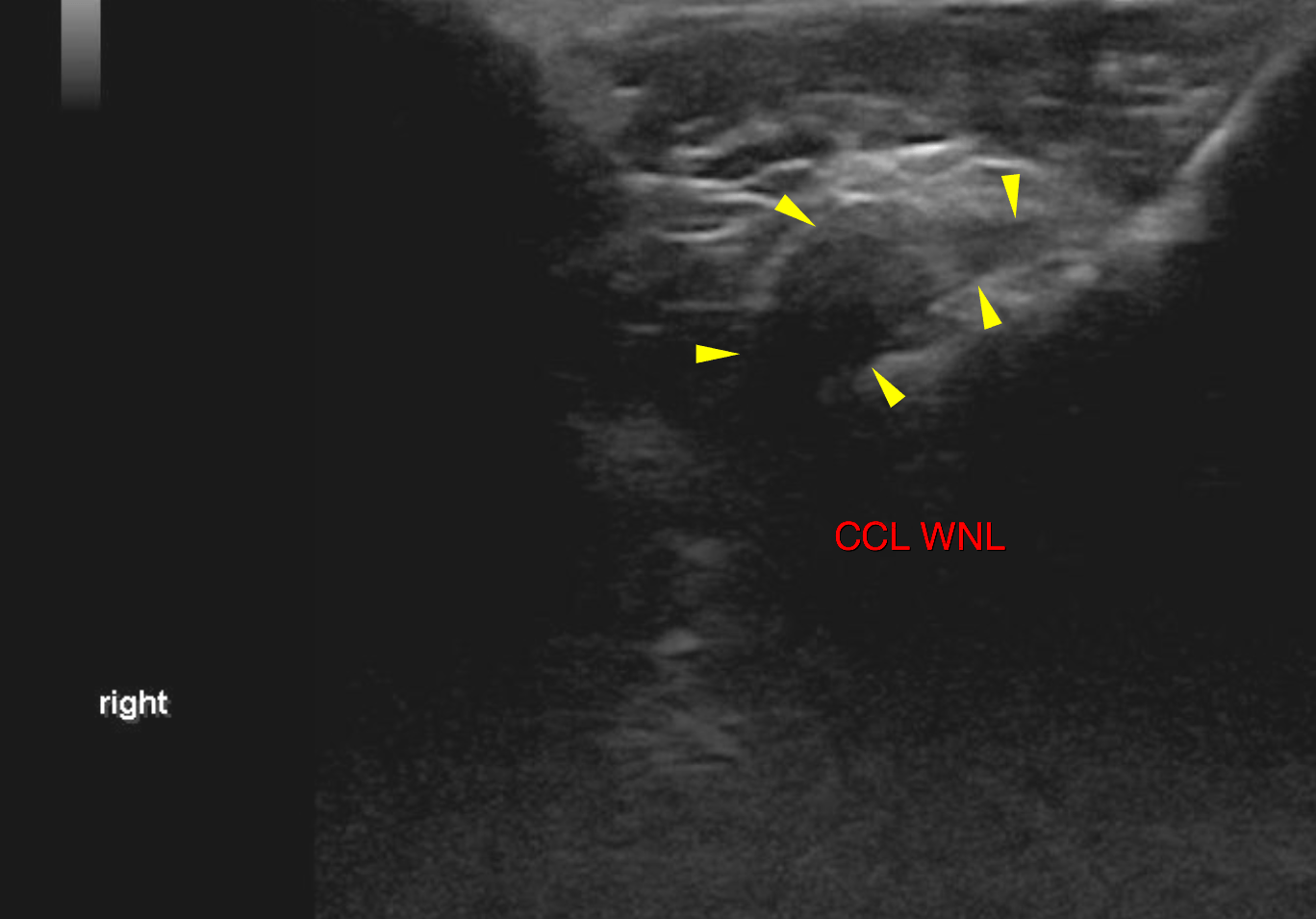 RAD and ORTHO- Coxofemoral arthritis and cranial cruciate ligament(CCL ...