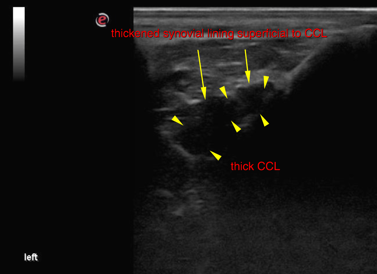 RAD and ORTHO- Coxofemoral arthritis and cranial cruciate ligament(CCL ...