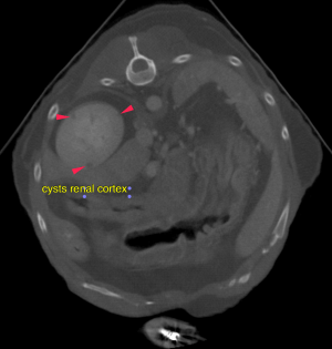 CT – Cystolithiasis with multiple cortical renal cysts in a 10 year old ...